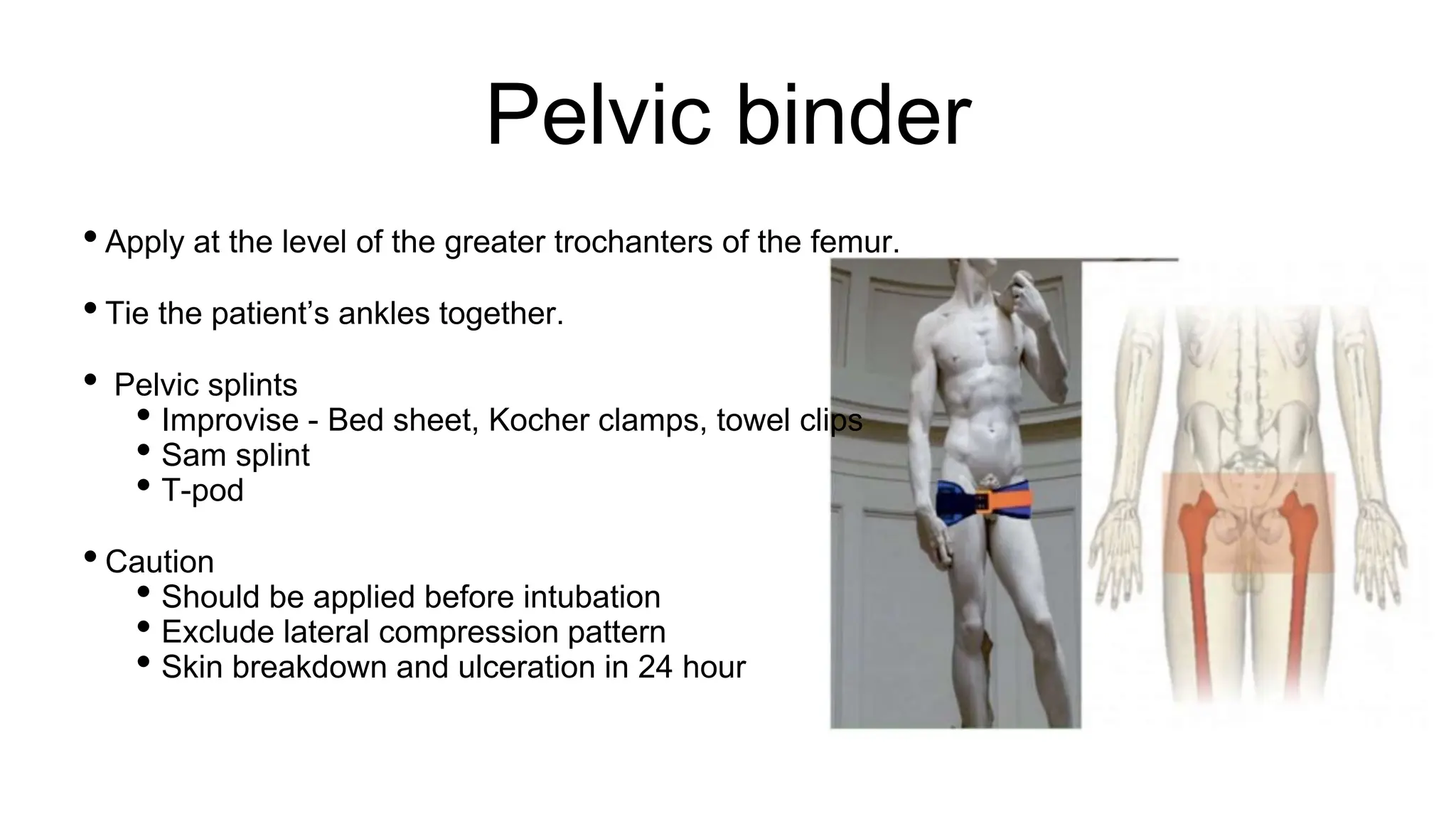 Pelvic Fracture managemnt- Case based discussion .pptx