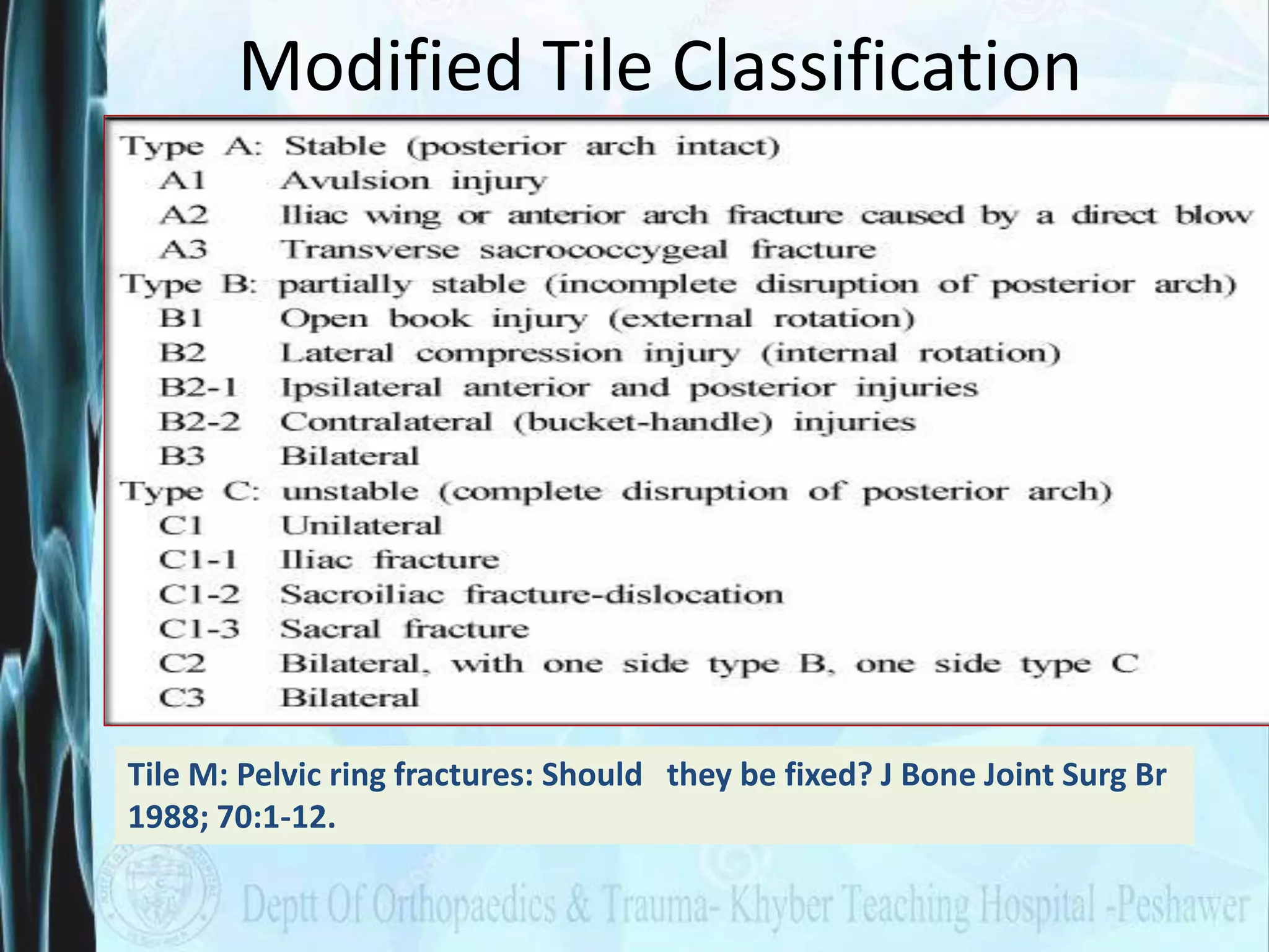 Pelvic fracture classification | PPTX