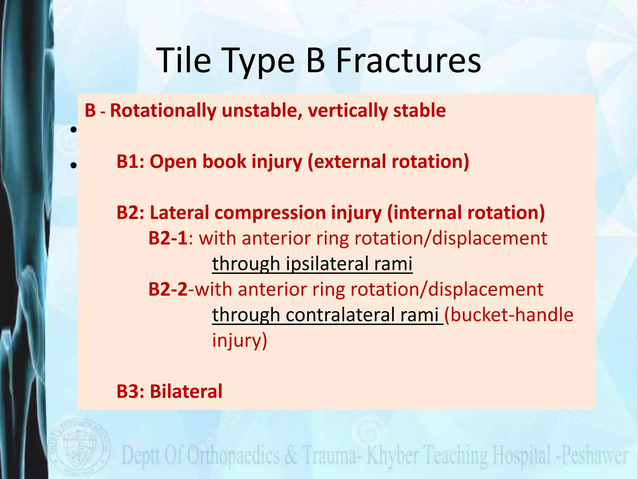 Pelvic fracture classification | PPTX