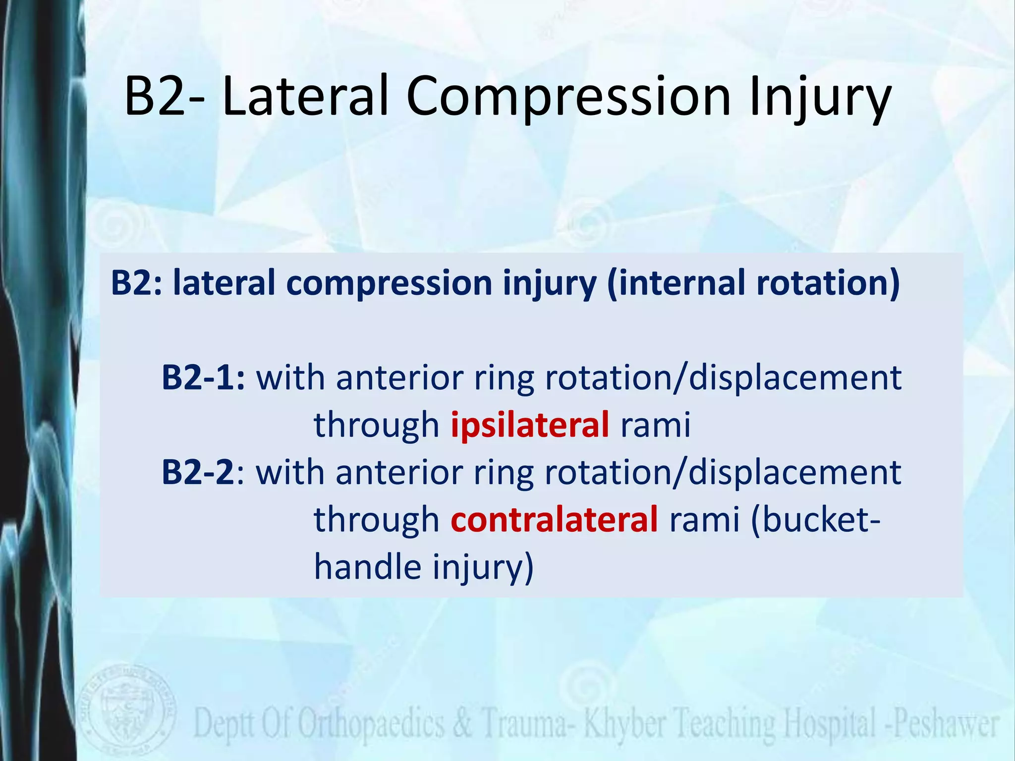 Pelvic fracture classification | PPTX