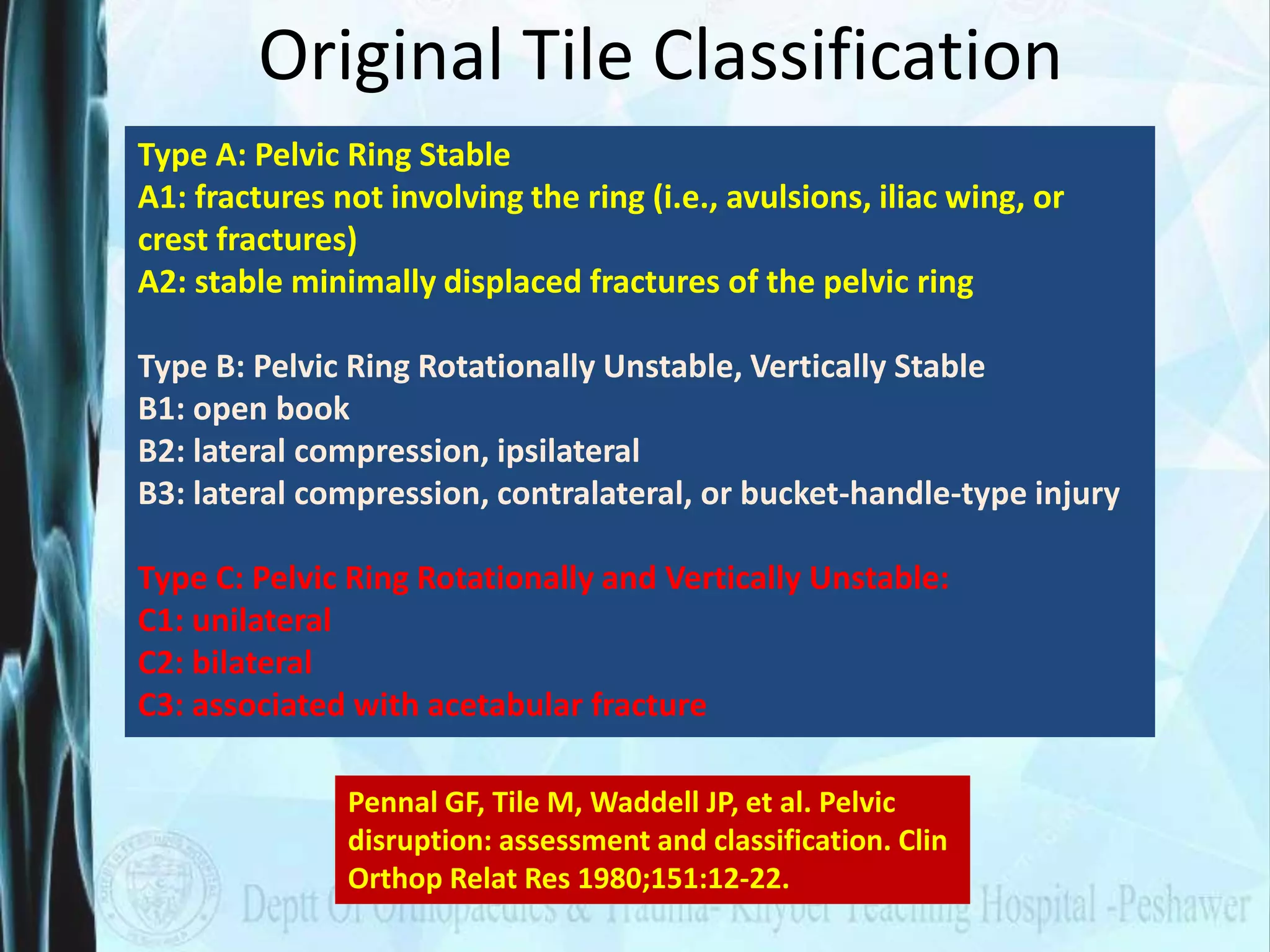 Pelvic fracture classification | PPTX