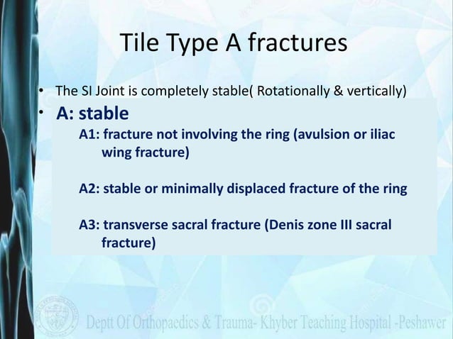 Pelvic fracture classification | PPTX