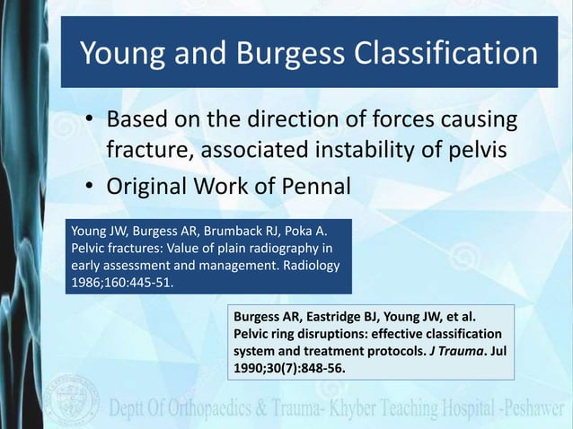 Pelvic fracture classification | PPTX