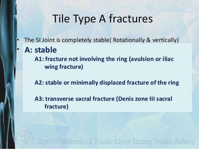 Classification Of Pelvis And Aetabulum Injuries Trauma