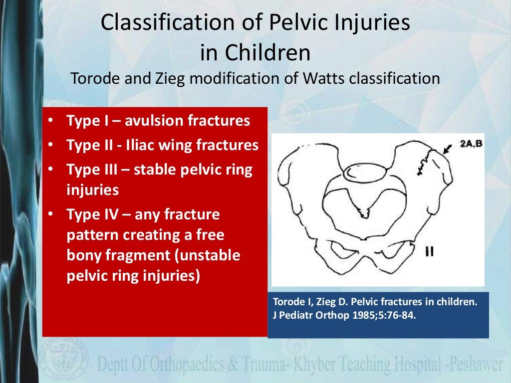 Pelvic fracture classification