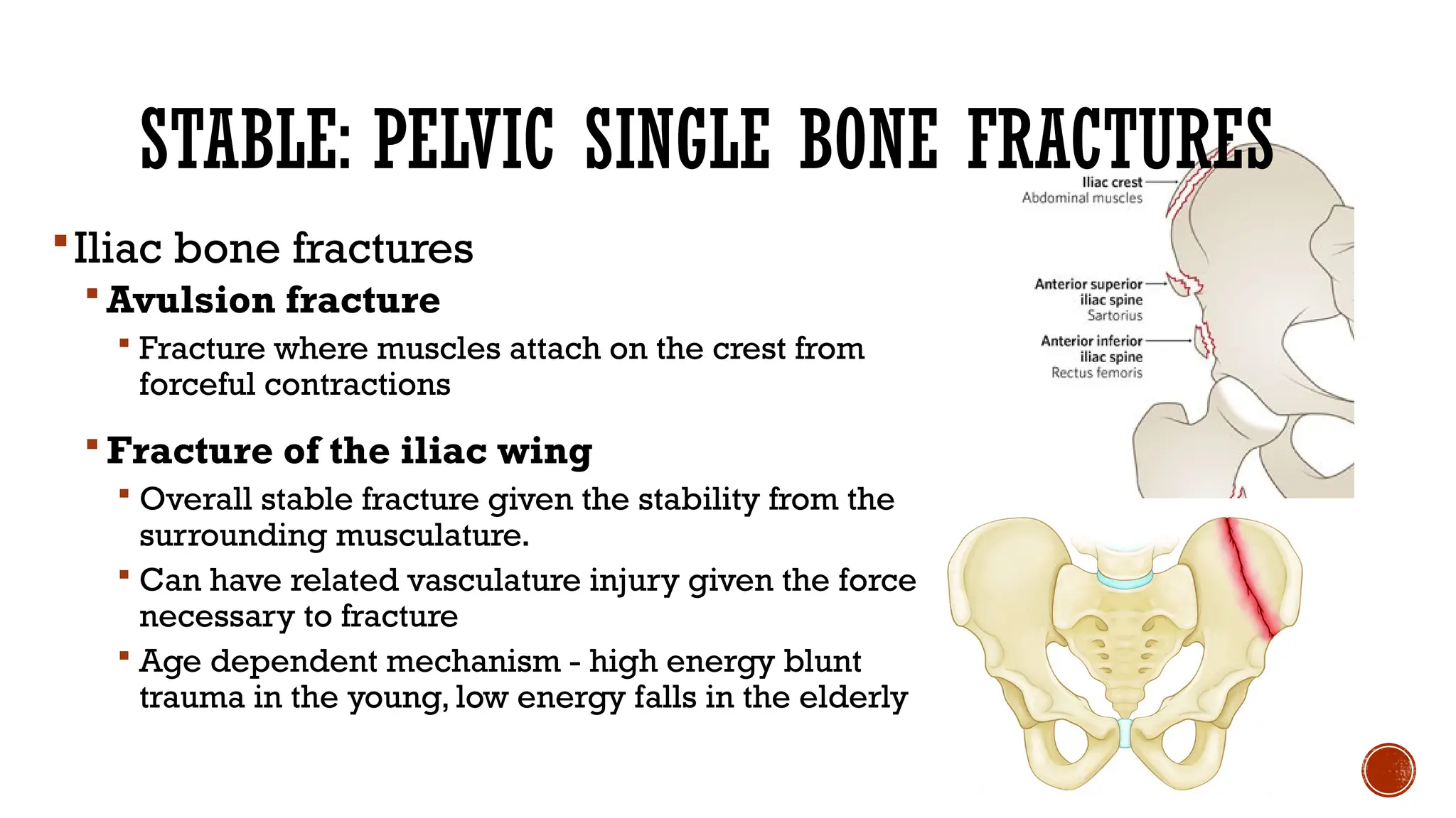 Field management of Pelvic Fracture CME.pptx