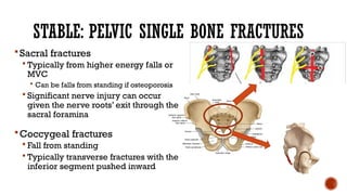 Field management of Pelvic Fracture CME.pptx