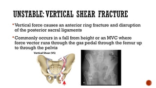 Field management of Pelvic Fracture CME.pptx