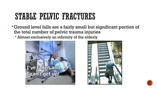 Field management of Pelvic Fracture CME.pptx