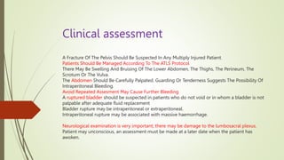 Pelvic fracture basic | PPT