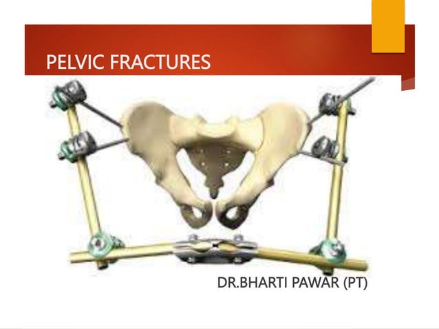 PELVIC FRACTURE ppt by dr.bharti pawar.ppt