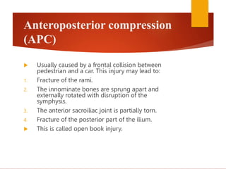 PELVIC FRACTURE ppt by dr.bharti pawar.ppt