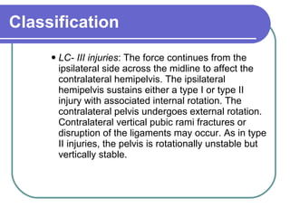 Pelvic fractures | PPT