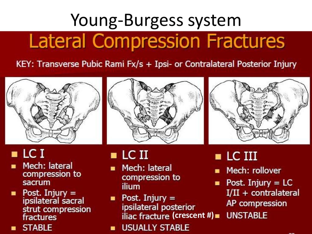 Pelvic fractures