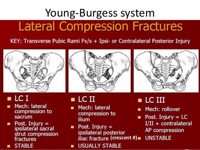 Pelvic fractures