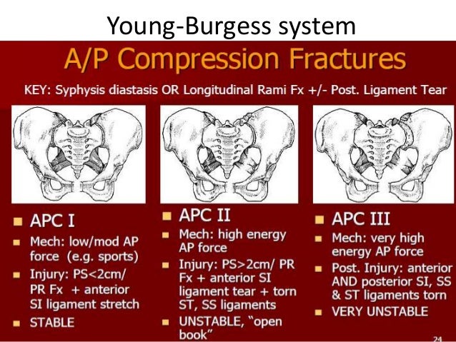 Pelvic fractures