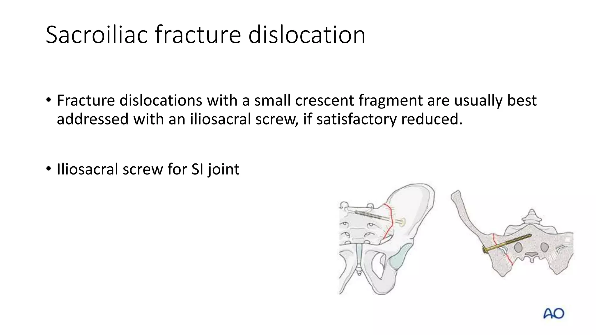 pelvic fractures.pptx