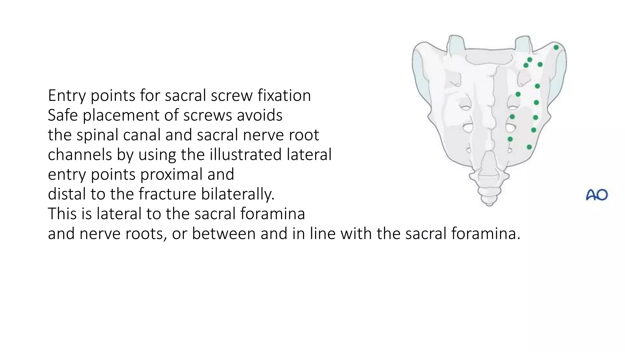 pelvic fractures.pptx