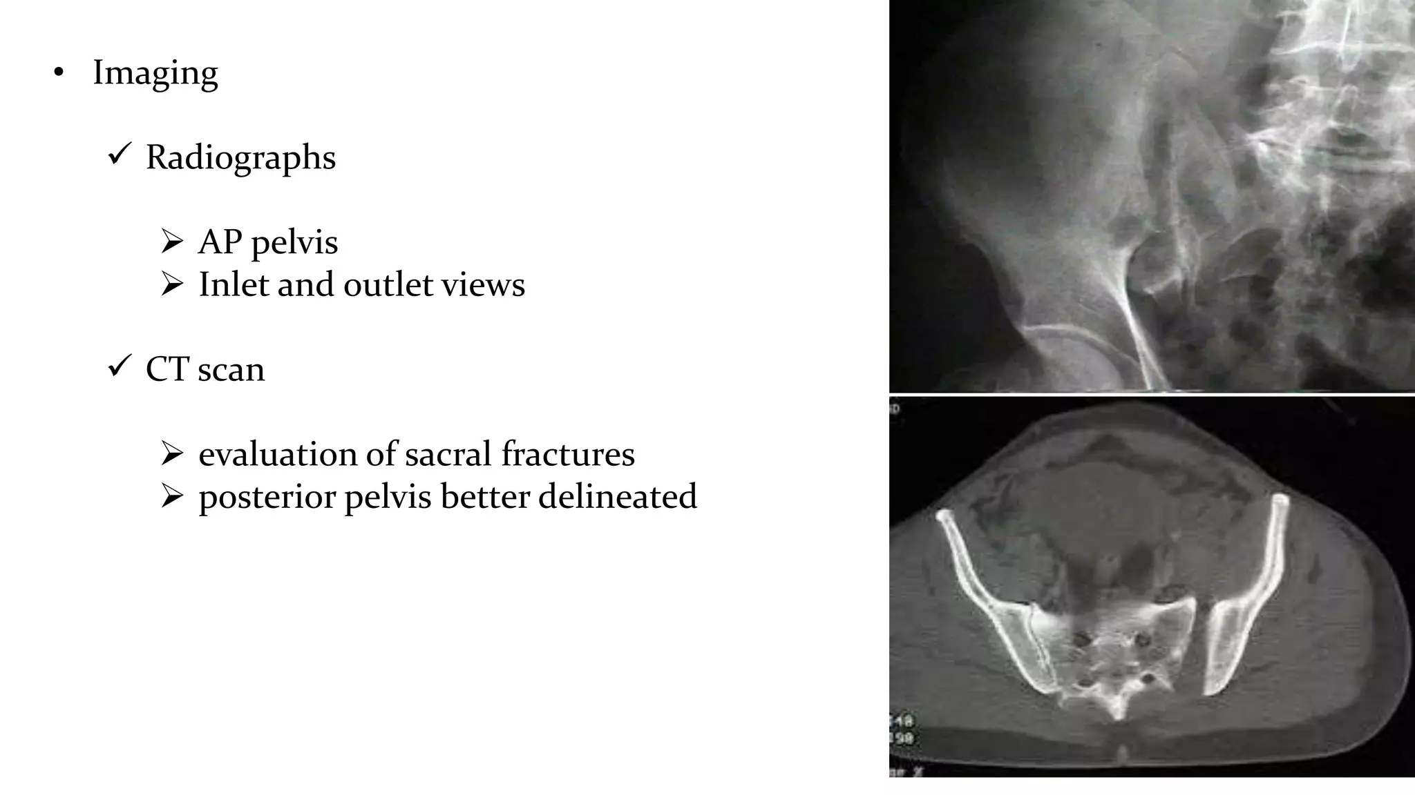 pelvic fractures.pptx
