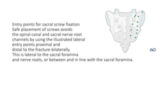 pelvic fractures.pptx