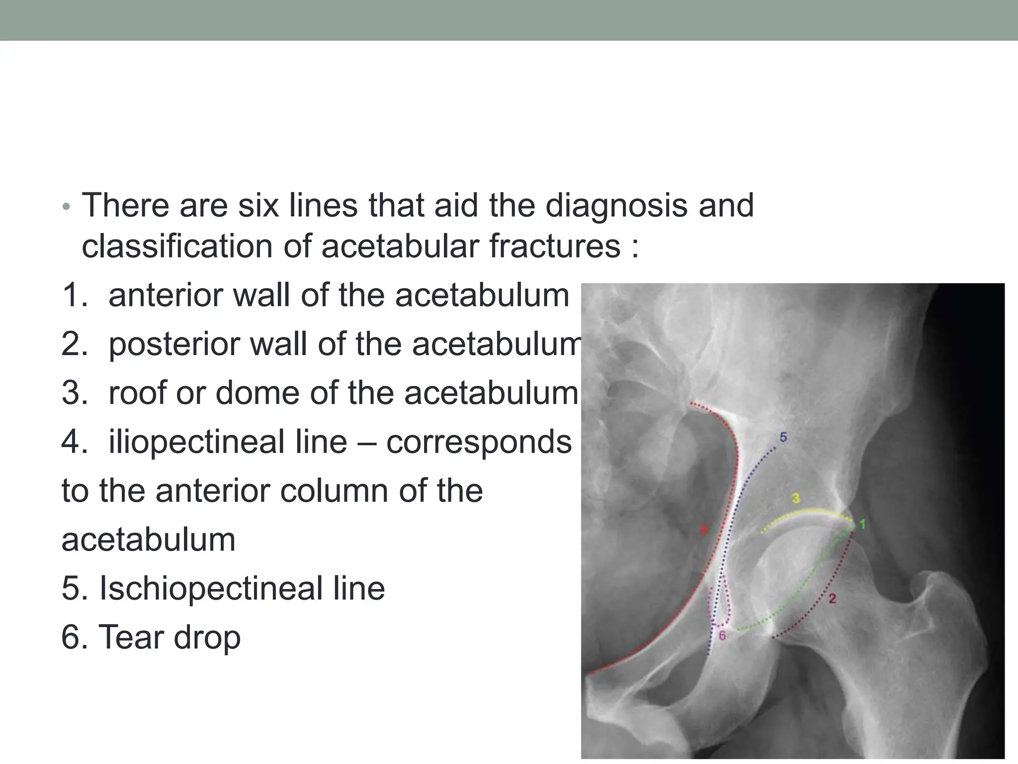 pelvic fractures.pptx