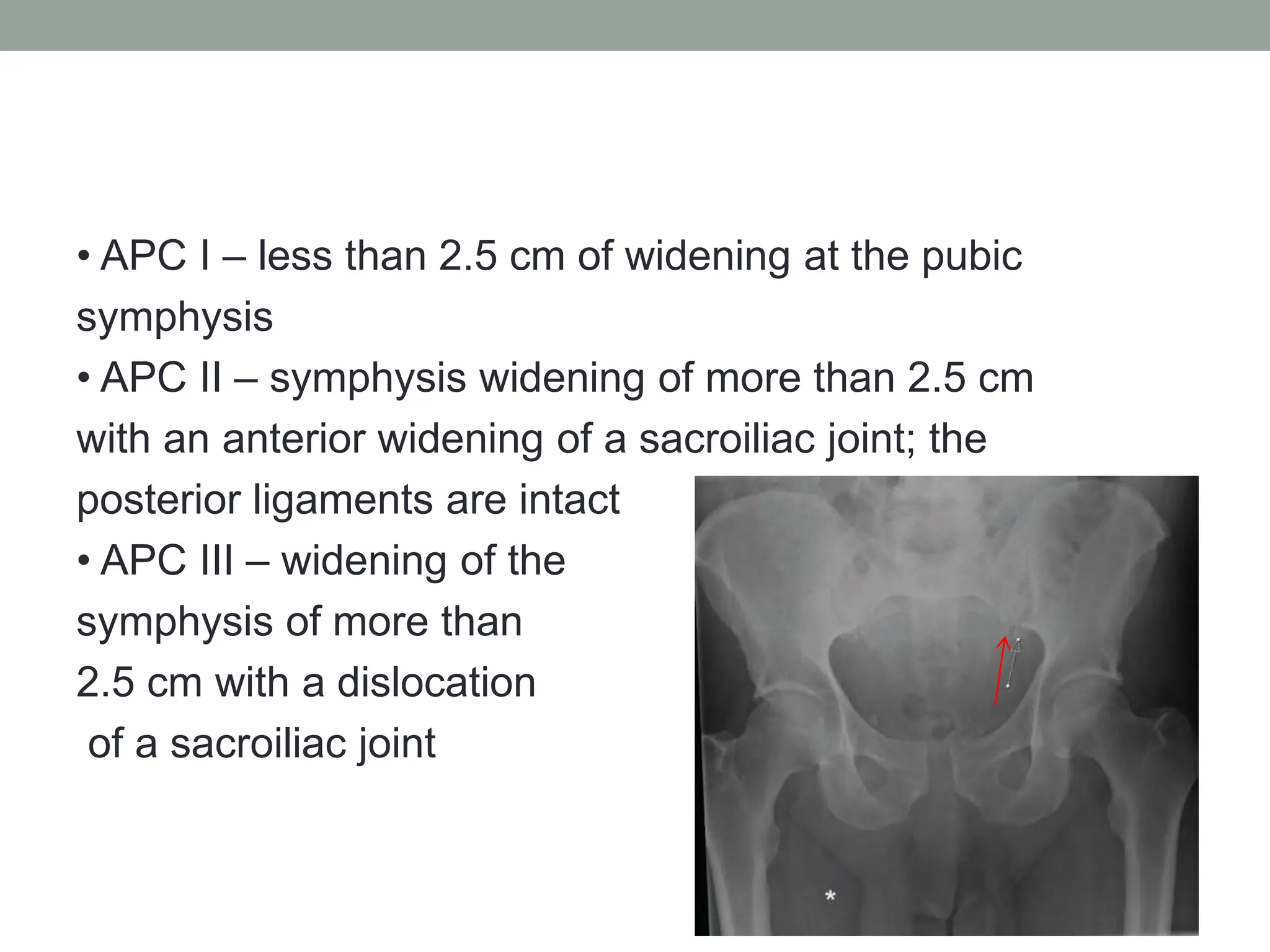 pelvic fractures.pptx