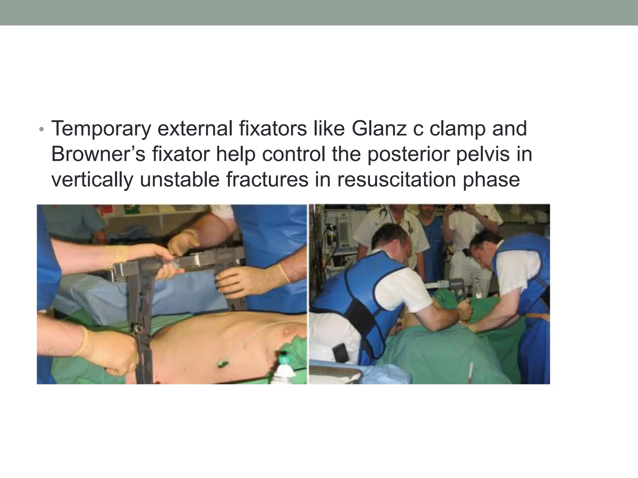 pelvic fractures.pptx