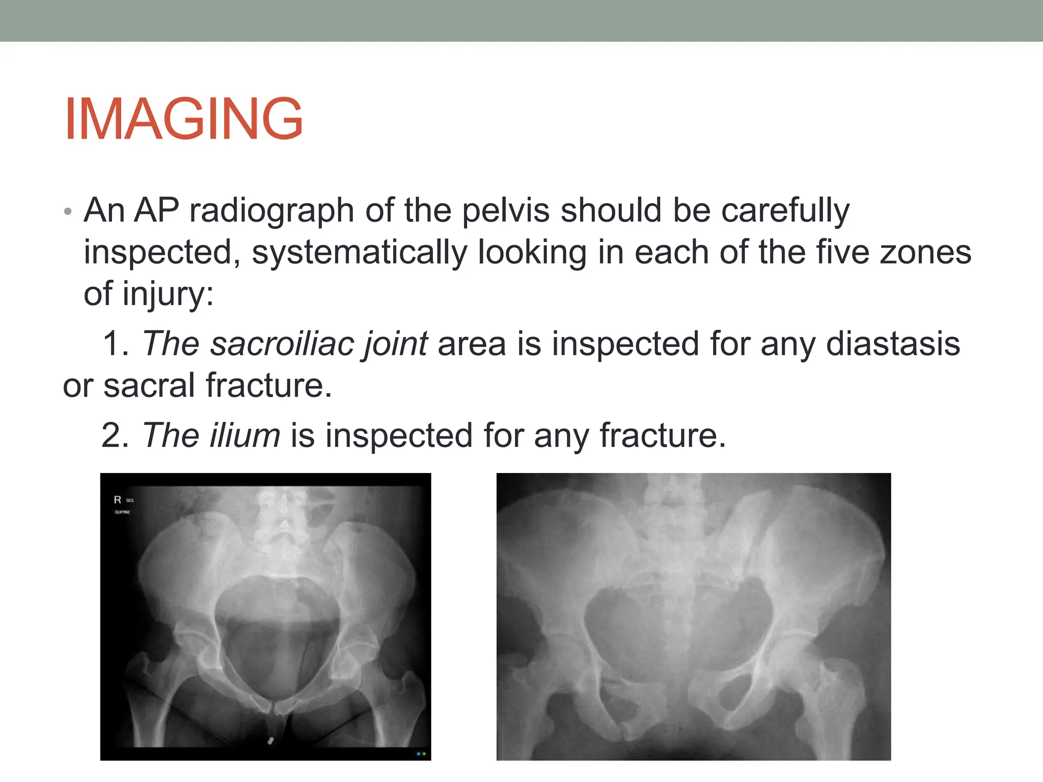 pelvic fractures.pptx