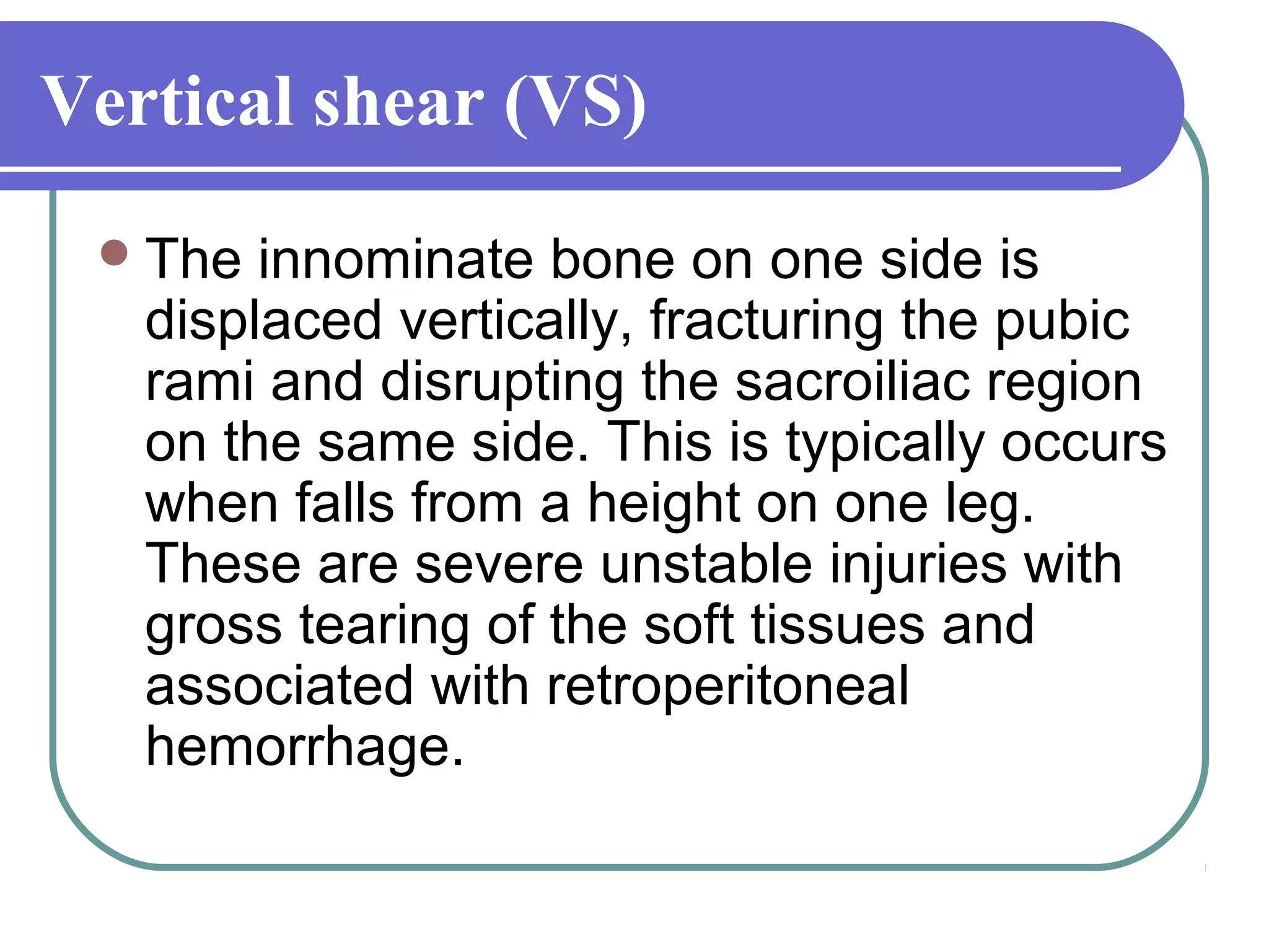 Pelvic fractures classification and management | PPT