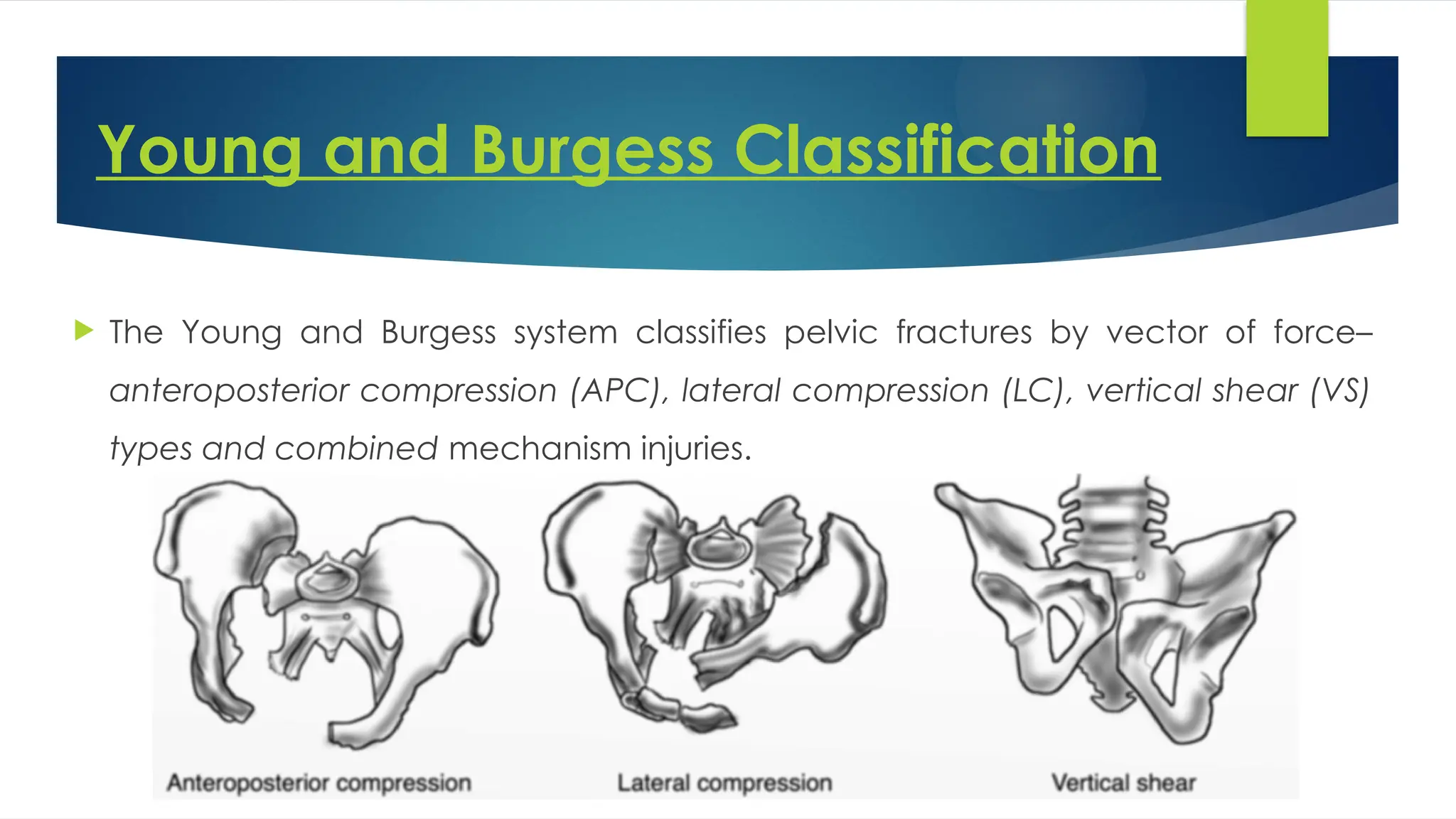 pelvic fractures NKC.pptx by Dr Chigali N | PPTX