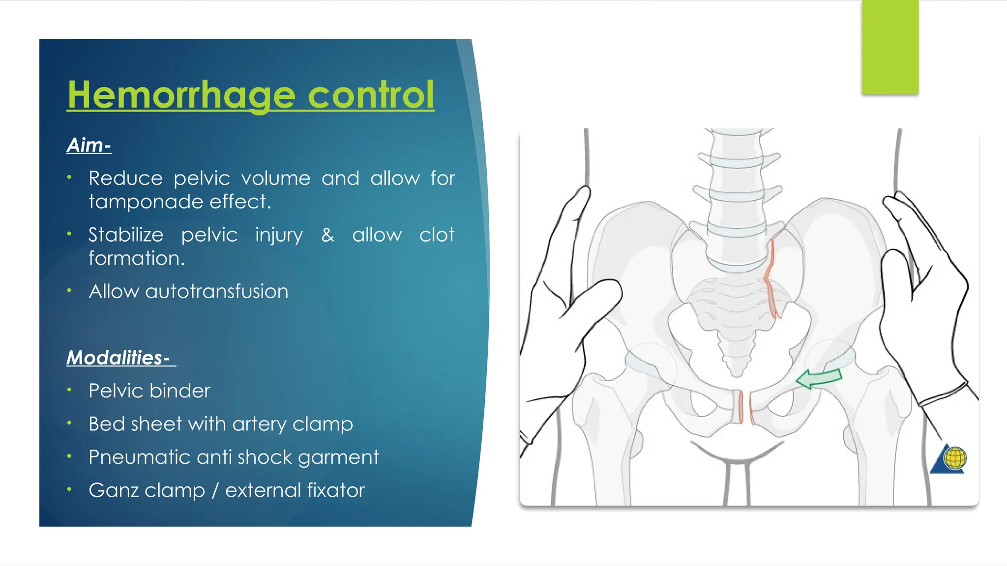 pelvic fractures NKC.pptx by Dr Chigali N | PPTX