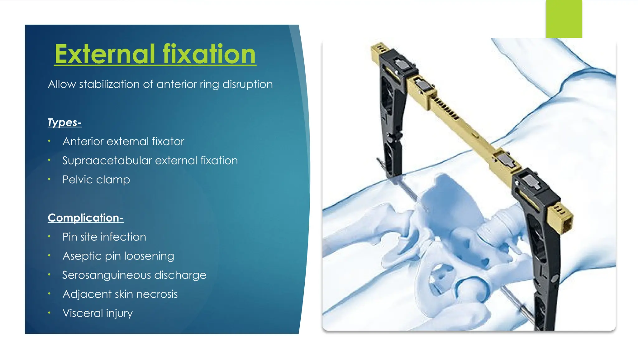 pelvic fractures NKC.pptx by Dr Chigali N | PPTX