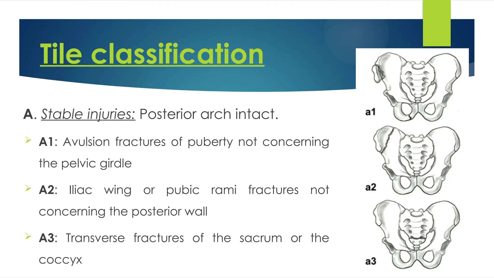 pelvic fractures NKC.pptx by Dr Chigali N | PPTX
