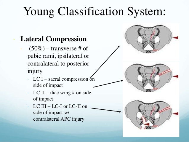 Pelvic fracure with haemodynamic instability