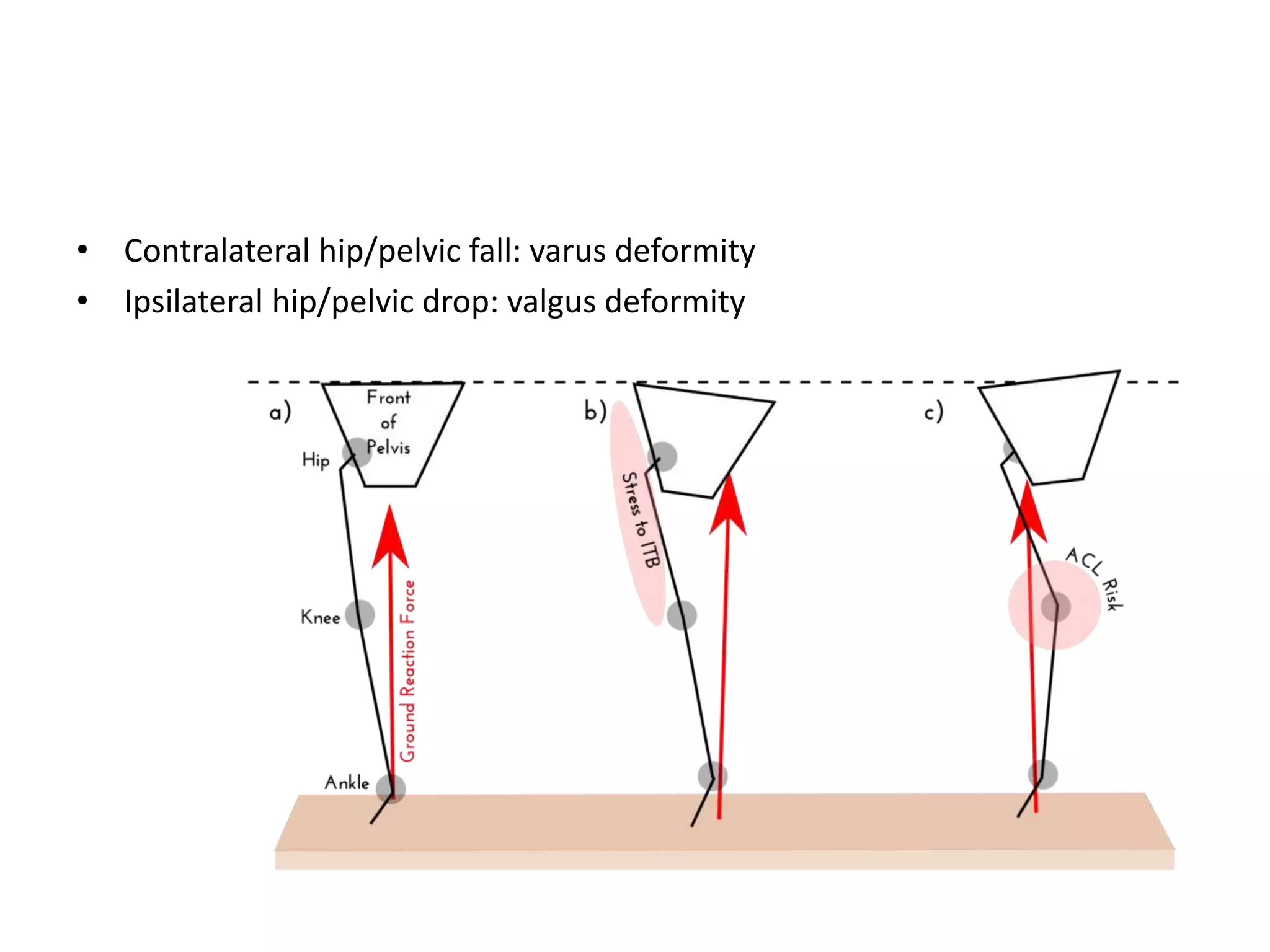 Pelvic, hip knee, Bones, Joints and Muscles | PPTX