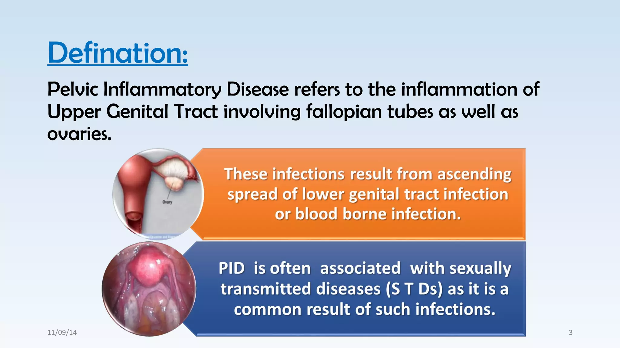 Pelvic inflammatory disease by Dr.Shuchita chattree | PPS