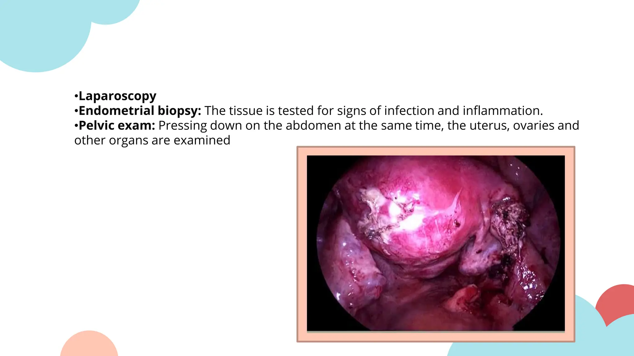 Pelvic Inflammatory Disease- acute and subclinical infection of the ...