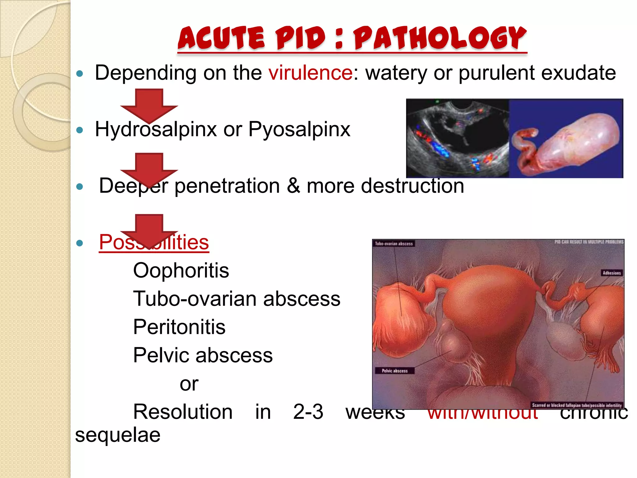 Pelvic inflammatory disease | PPTX