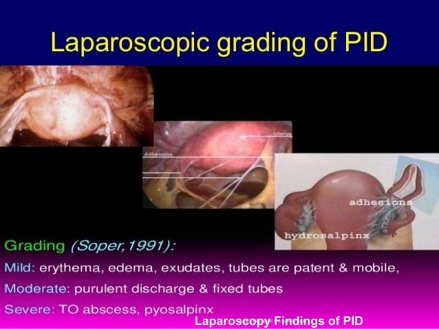 PID lecture by Associate Professor Dr Aisha Elbareg