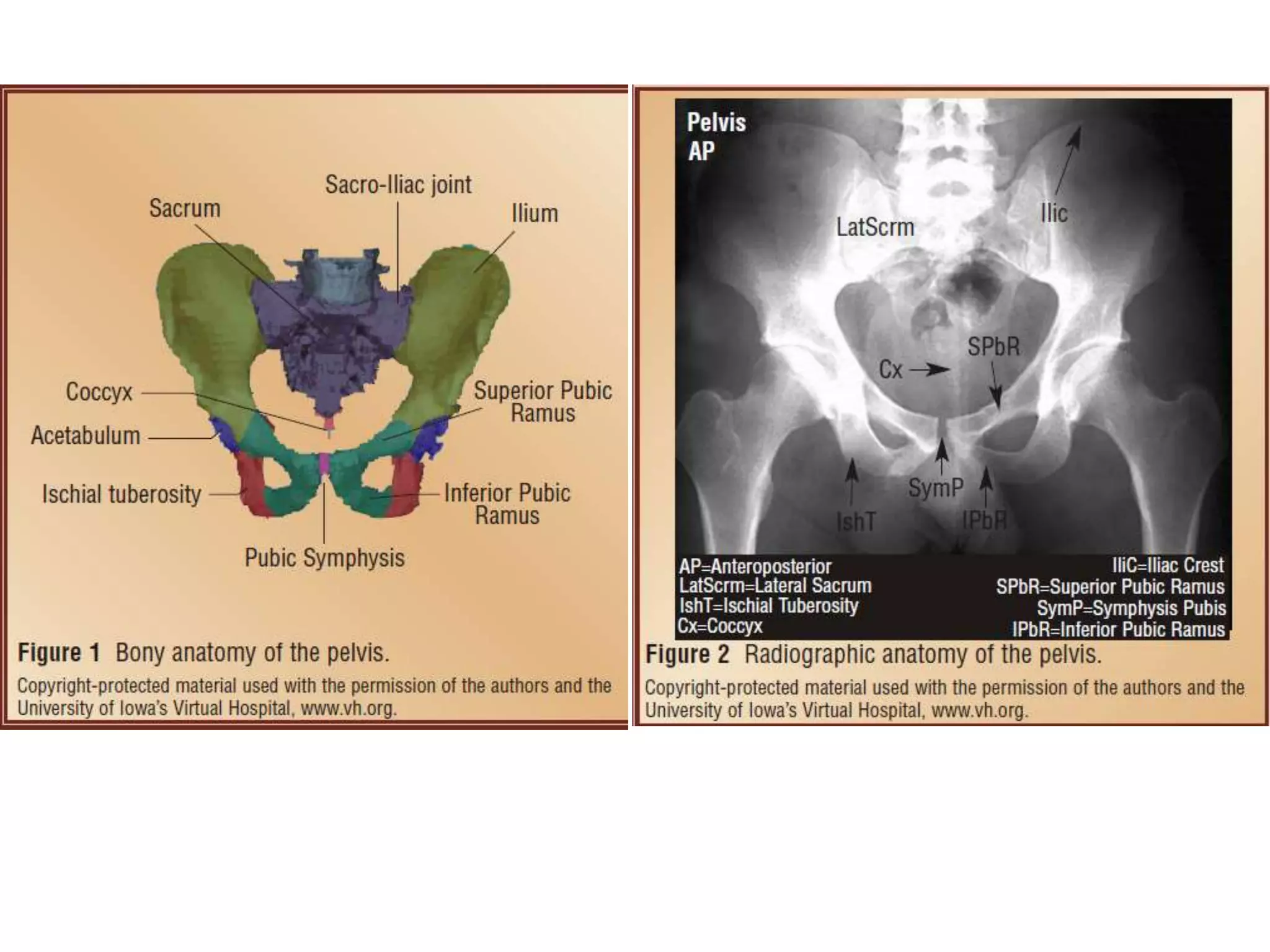Pelvic injuries | PPTX