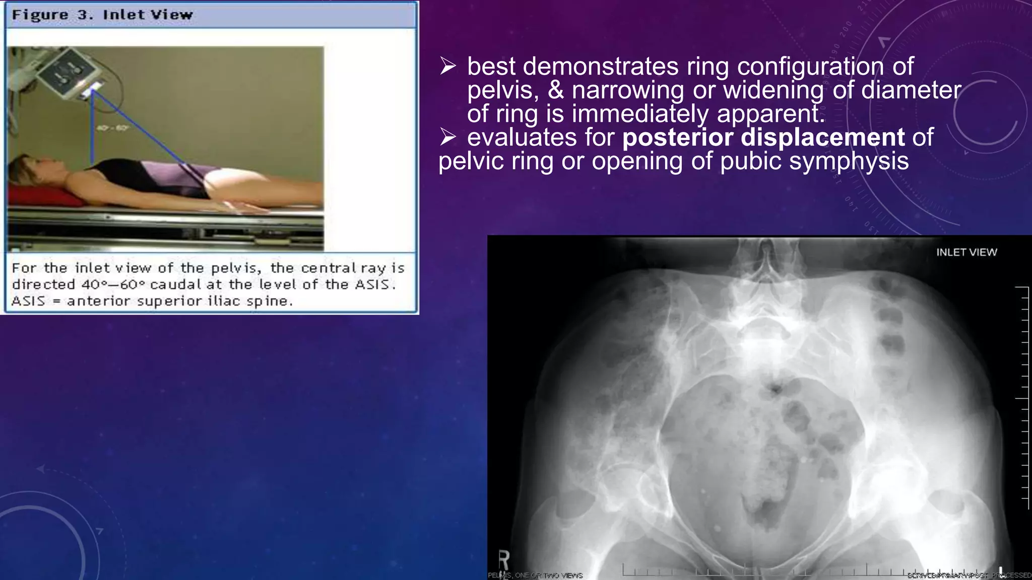 Pelvic injuries and associated injuries | PPTX