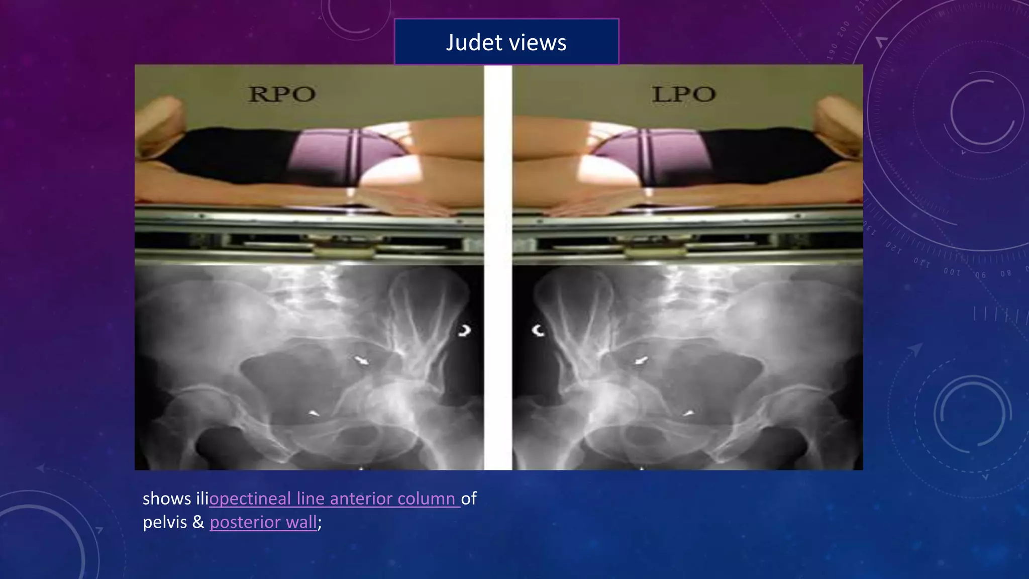 Pelvic injuries and associated injuries | PPTX