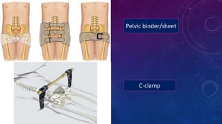 Pelvic injuries and associated injuries | PPTX