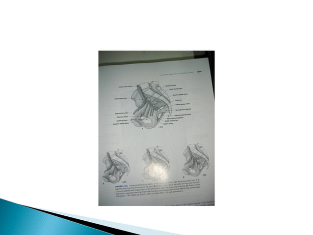 Pelvic injuries dr.satish | PPT