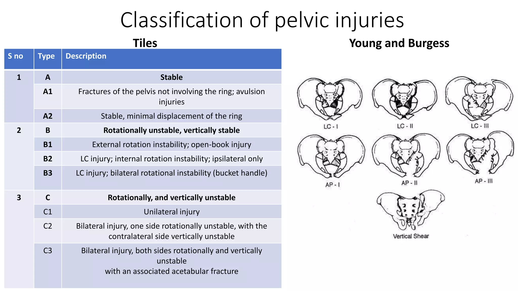 Pelvic injuries for MBBS (undergraduate medical education) | PPTX