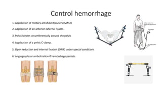 Pelvic injuries for MBBS (undergraduate medical education) | PPTX