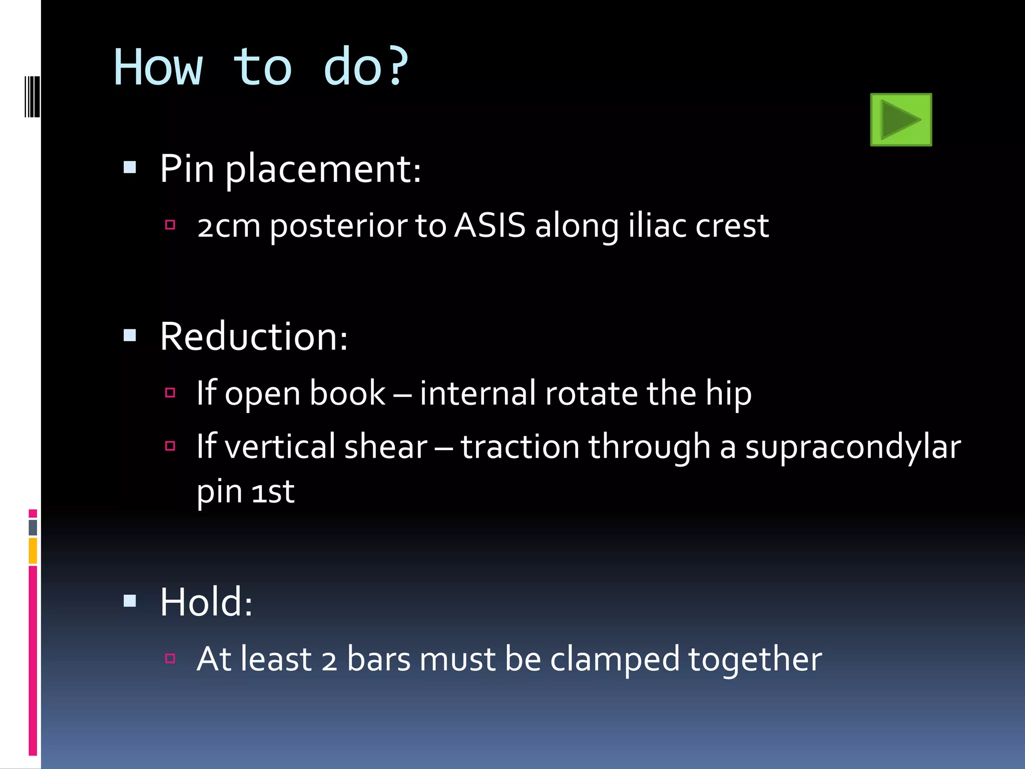Pelvic injuries trauma 2012 | PPTX