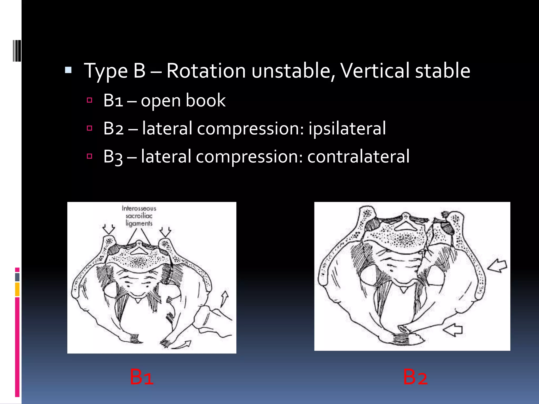 Pelvic injuries trauma 2012 | PPTX