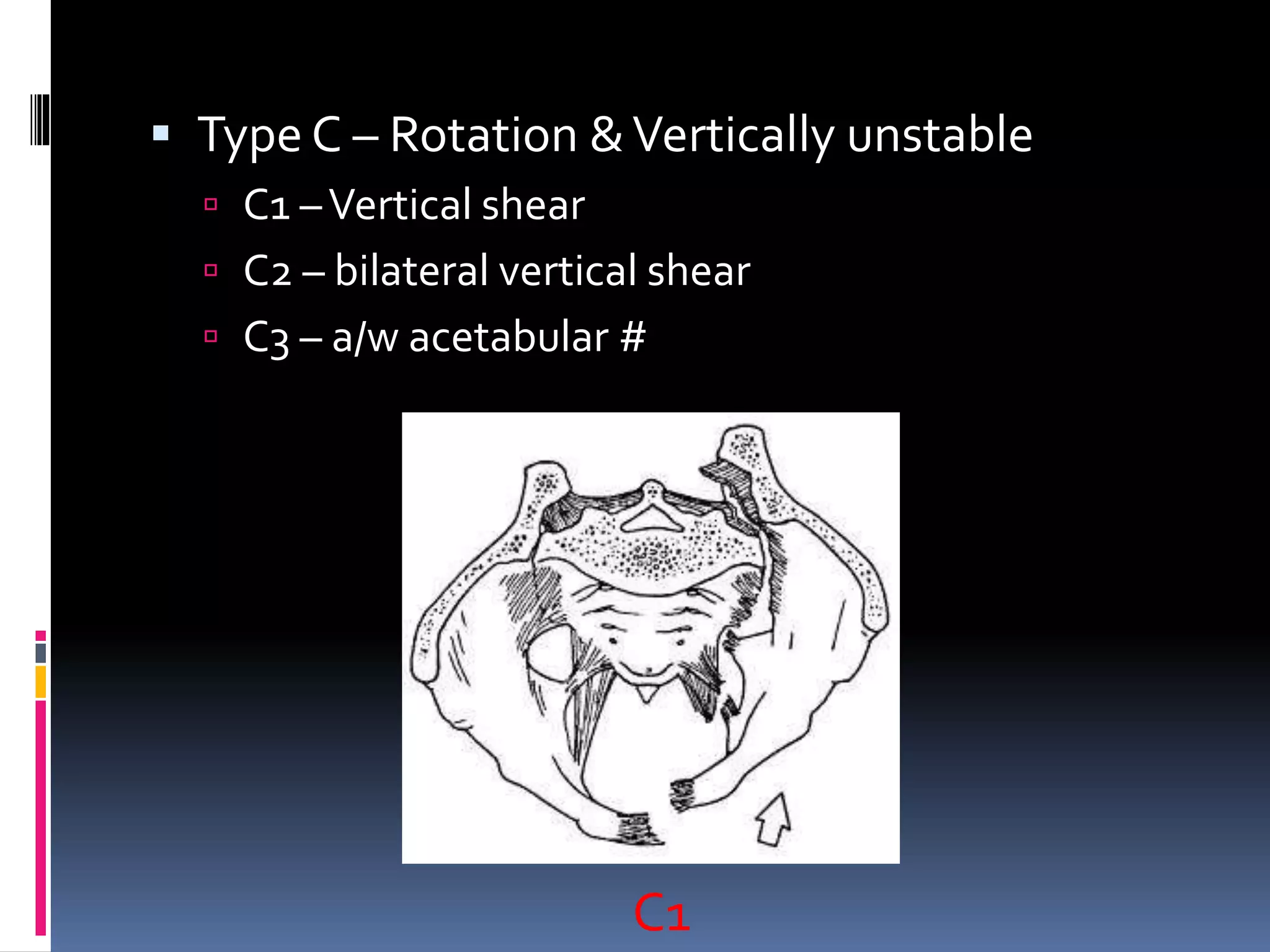 Pelvic injuries trauma 2012 | PPTX