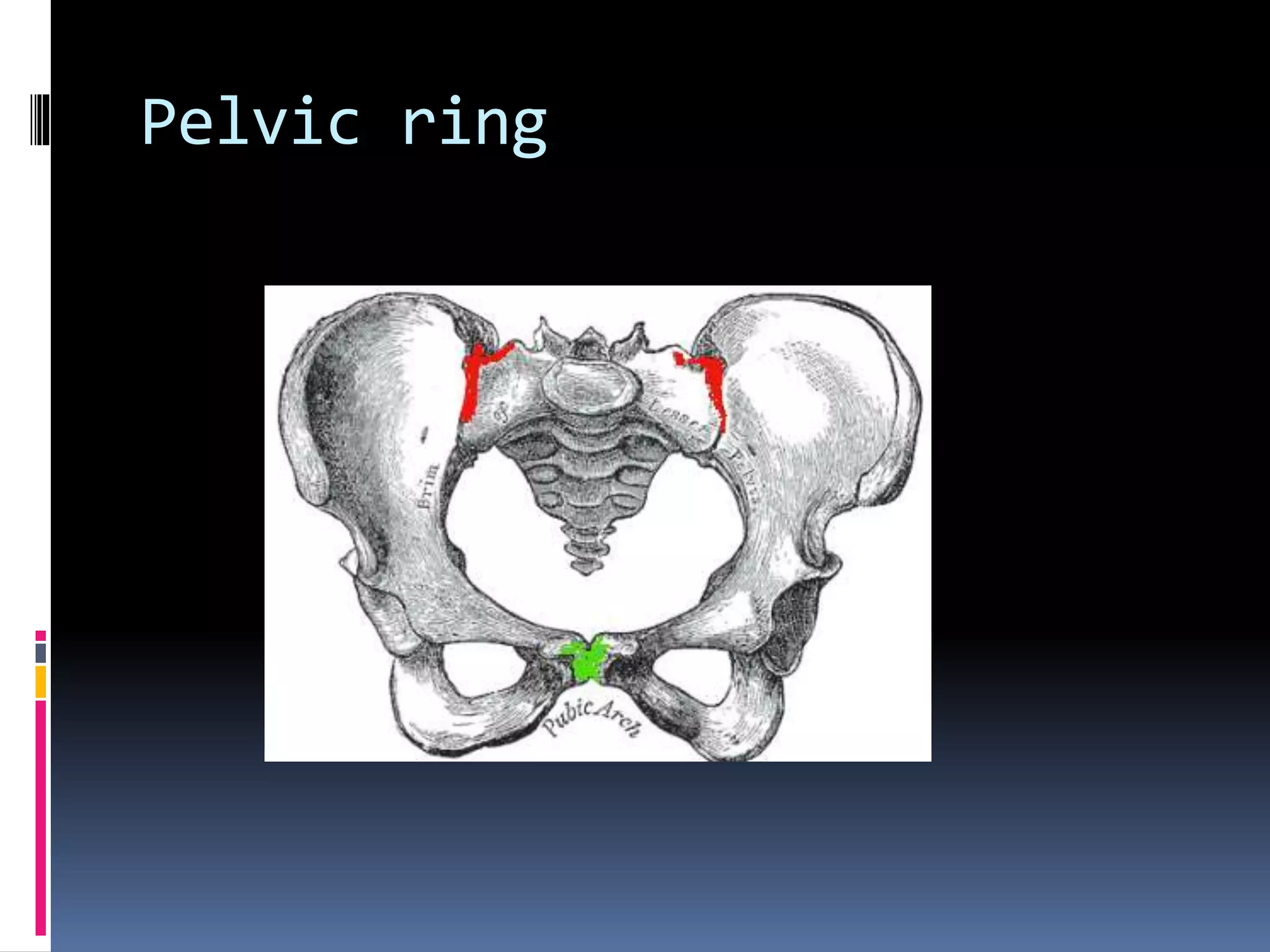 Pelvic injuries trauma 2012 | PPTX